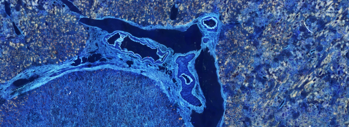 Spatial Biology Europe: Online